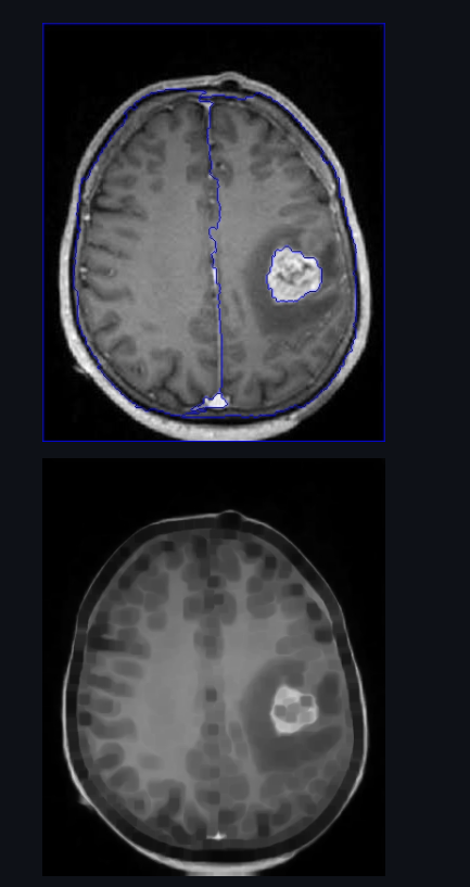 GitHub - KanishkaGhosh21/BRAIN-TUMOR-DETECTION-USING-MRI-SCANS