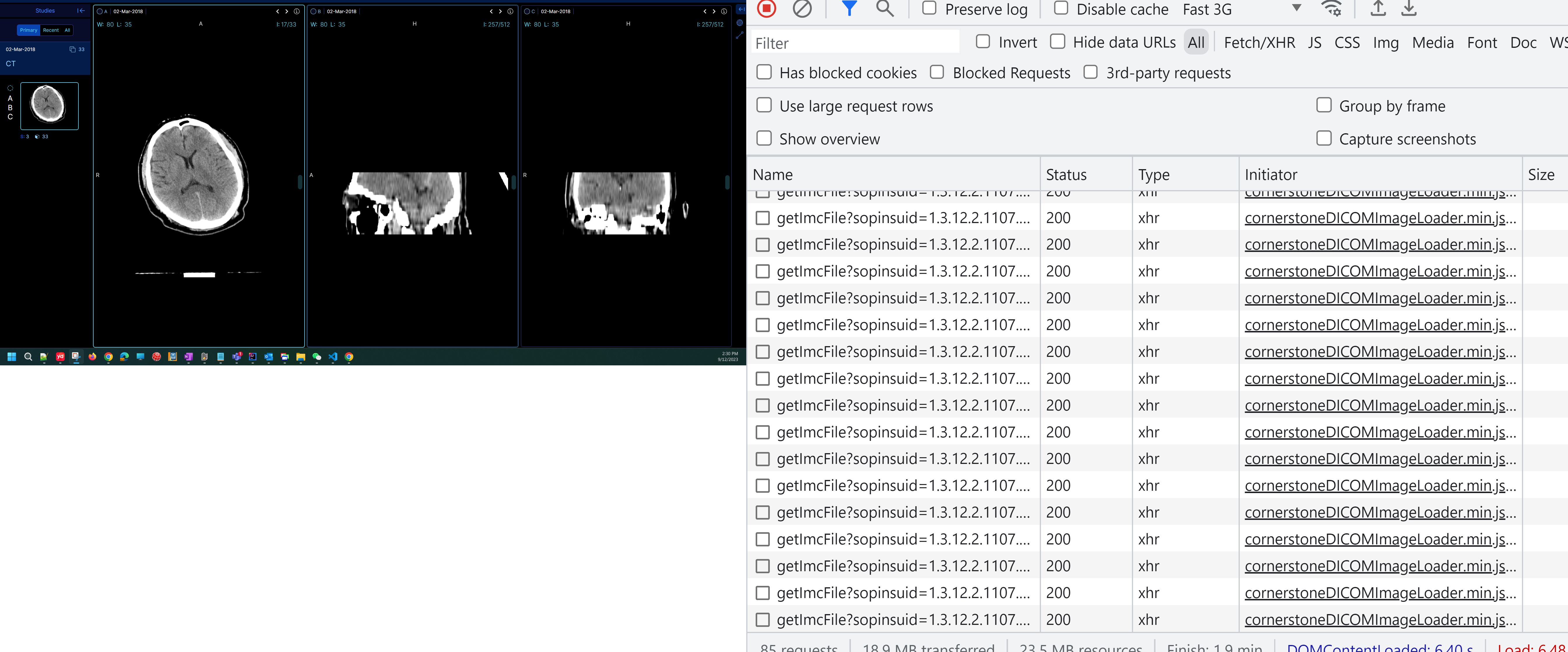 [Bug] MPR cannot reconstruct correctly · Issue #3647 · OHIF/Viewers · GitHub