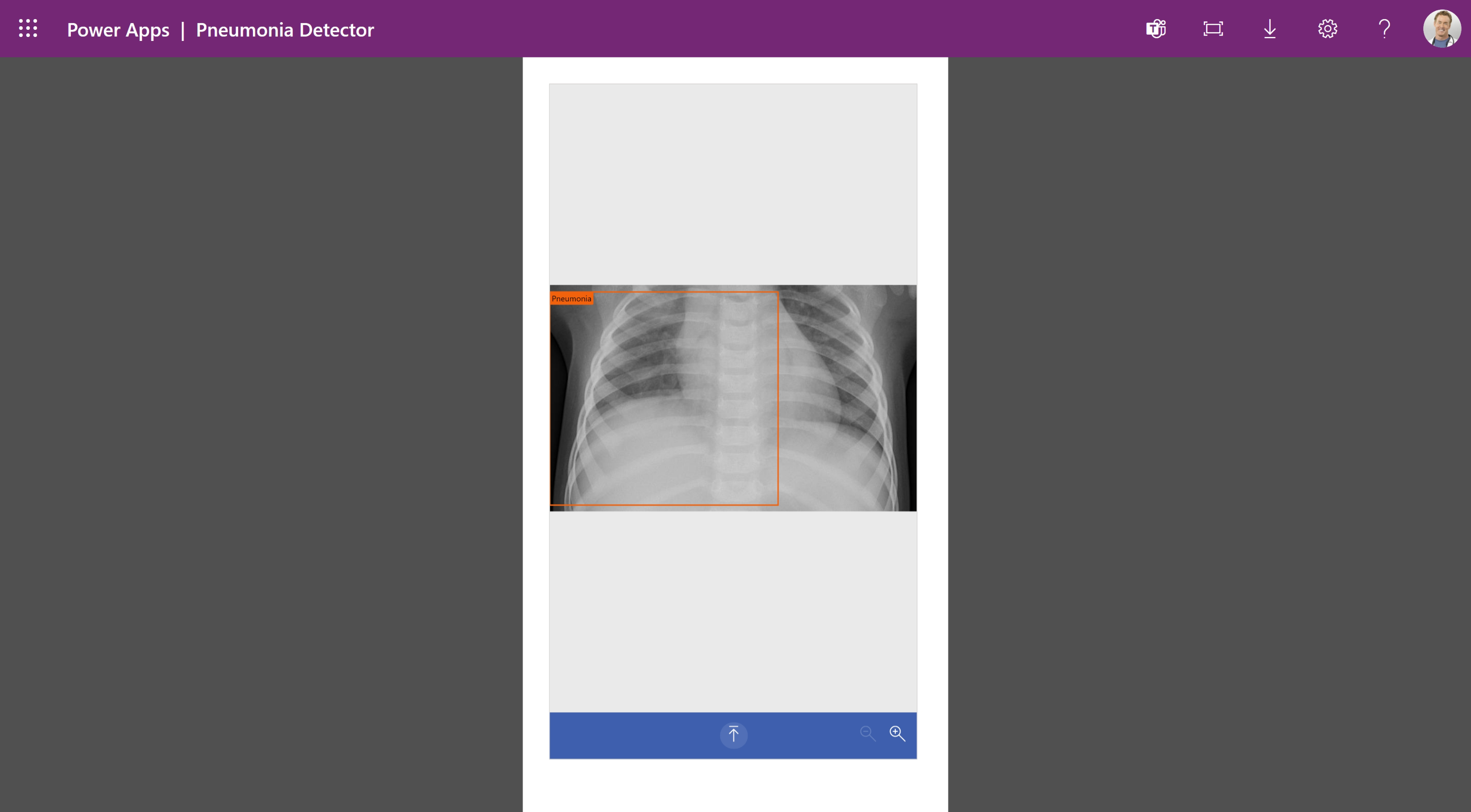 Pneumonia-Prediction-Model/README.md at main · olajideajayi/Pneumonia ...