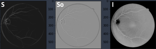 GitHub - bduartee/Automatic-Segmentation-of-Vessels-Retinas-in-Eye ...