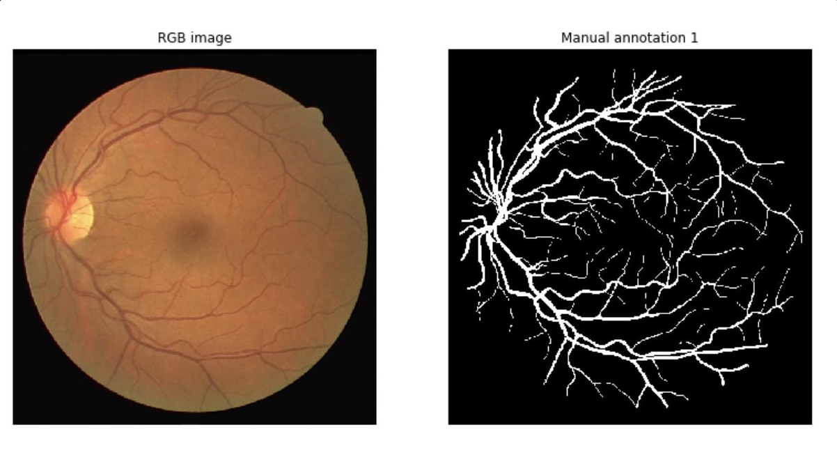 GitHub - bduartee/Computational-Algorithm-Acceleration-for-Automatic ...