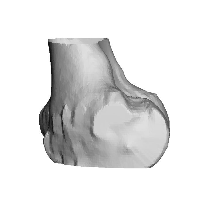 GitHub - aolwyn/minimum-area-triangulation-between-two-contours-in-3D ...