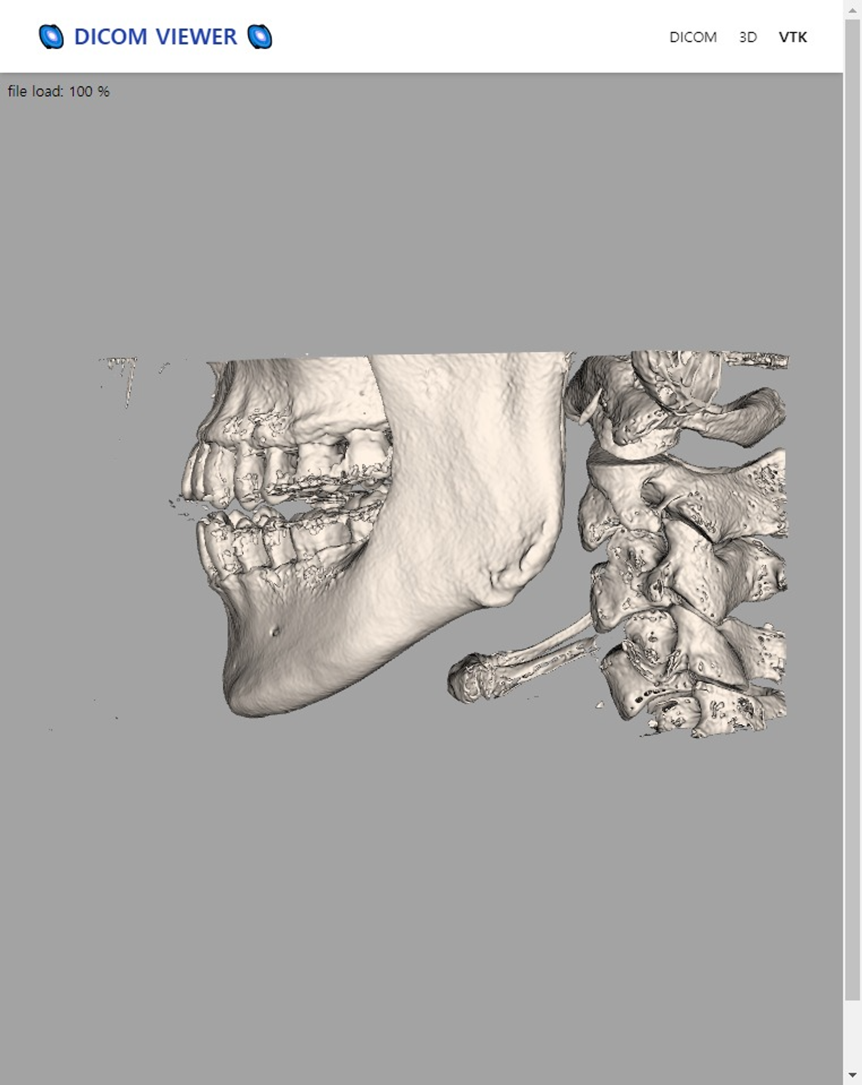 230627 - Study Volume rendering with vtk.js · Issue #15 · dusunax/dicom-and-three-js-viewer · GitHub
