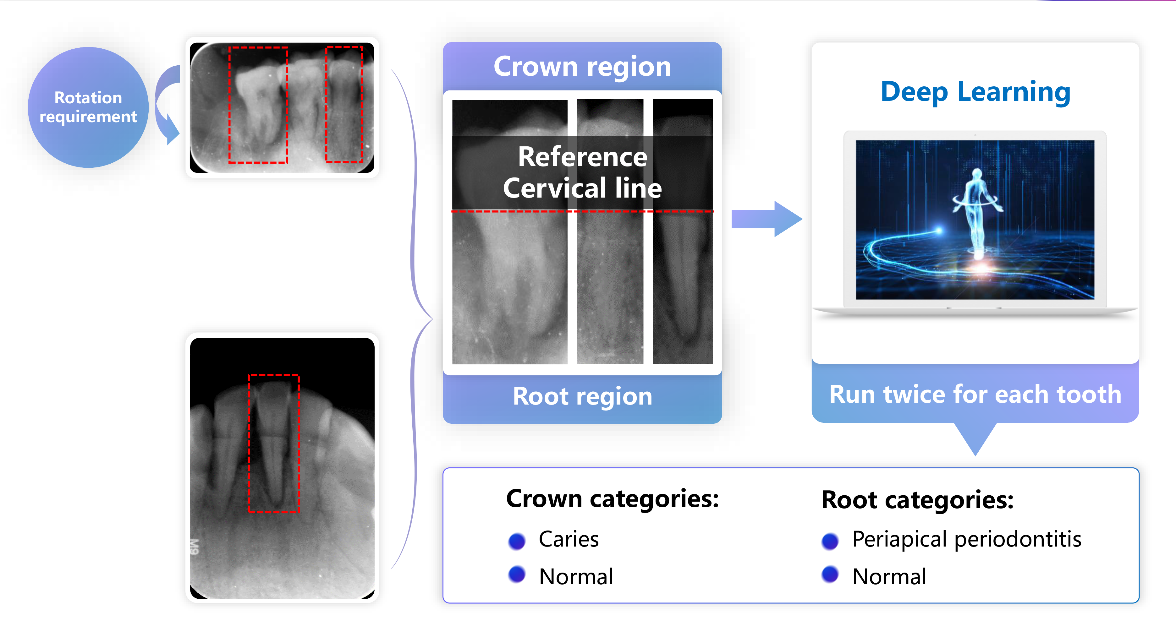 GitHub - Evassa5424/Caries-and-periapical-periodontitis-detection: Artificial intelligence for ...