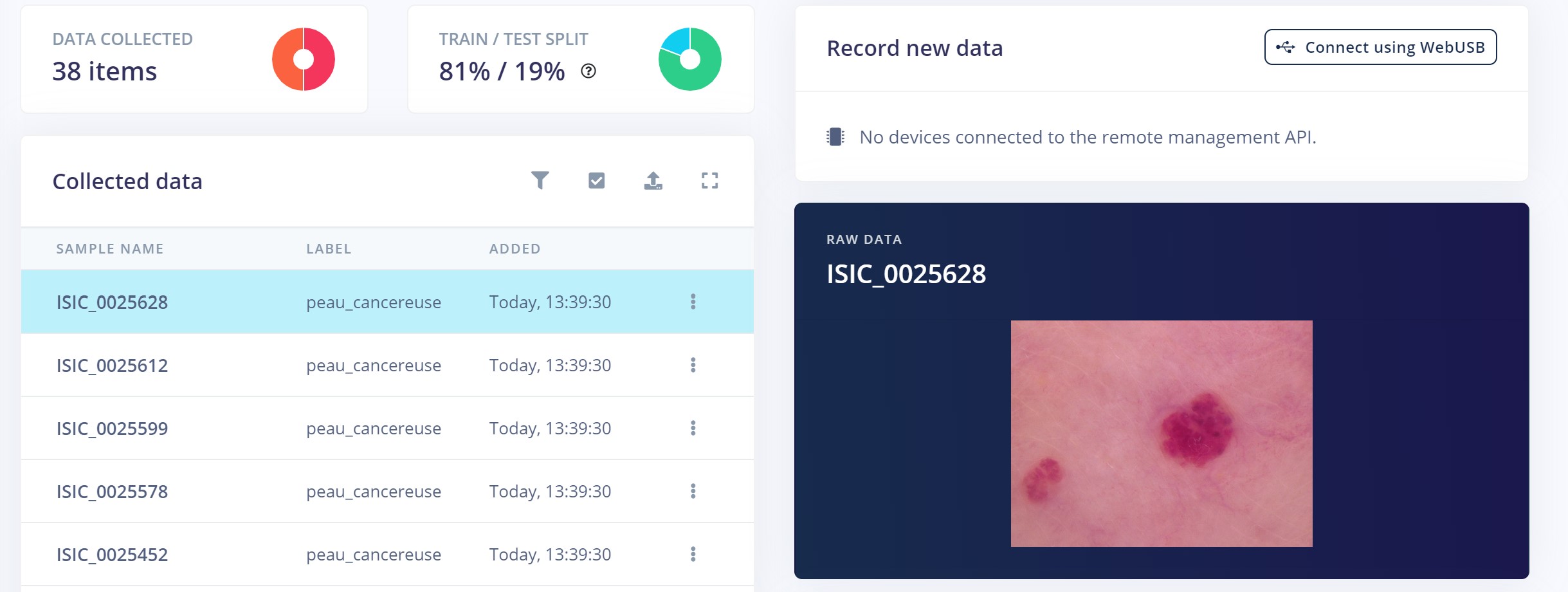 GitHub - raphael-gandus/TinyML: Projets pratiques TinyML