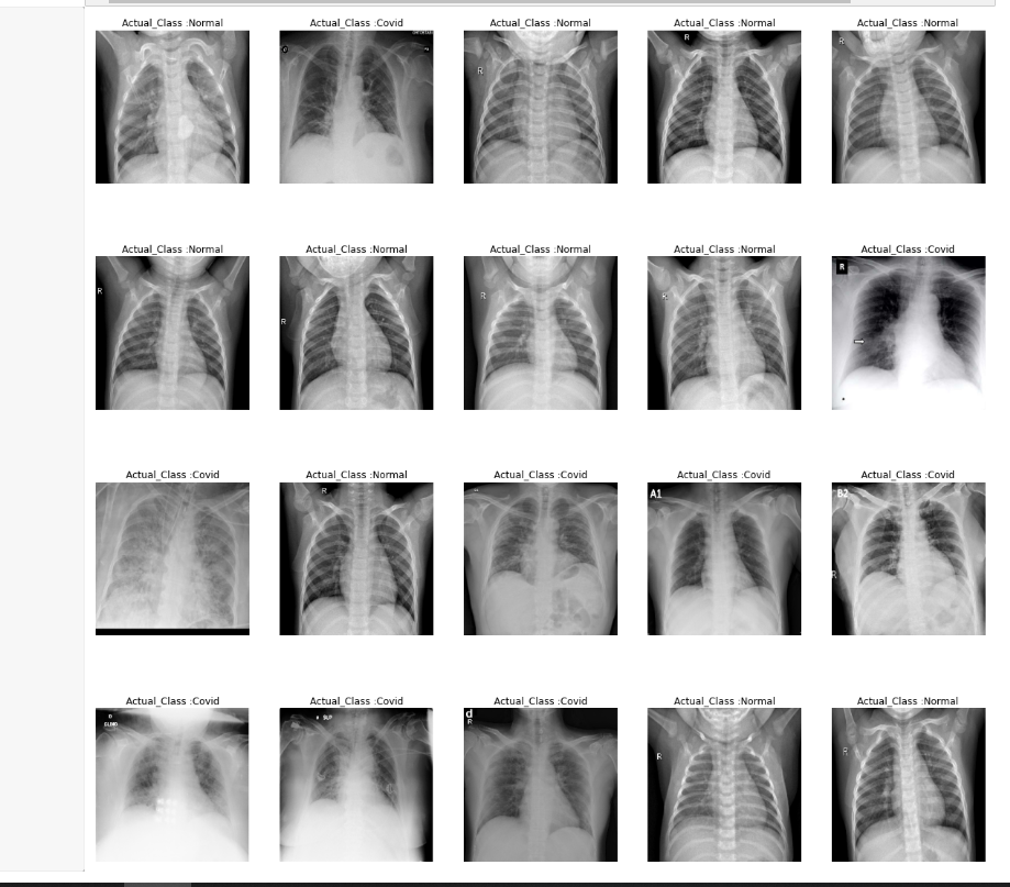 GitHub - GUNNER2K/covid_detection_using_Chest_Xrays