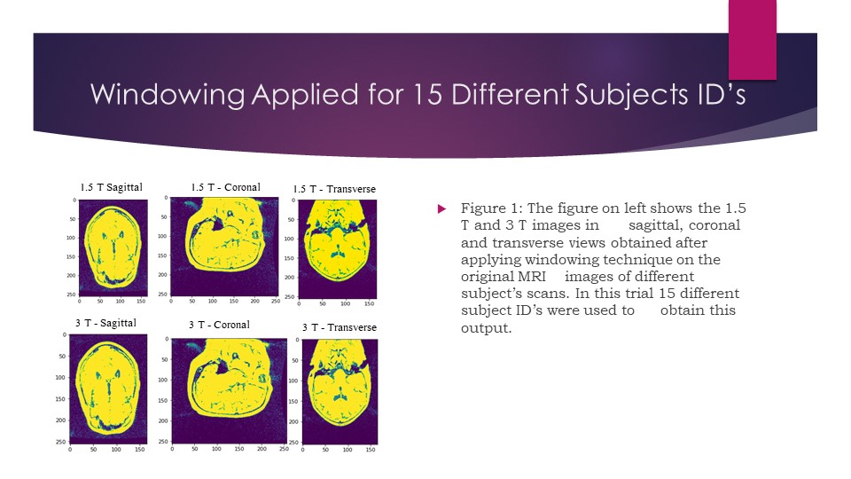 Github Saisjoshi Classification Alzheimers Disease 3d Vision Transformer