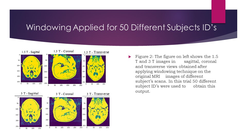 GitHub - SaiSJoshi/classification_alzheimers_disease_3D_vision_transformer