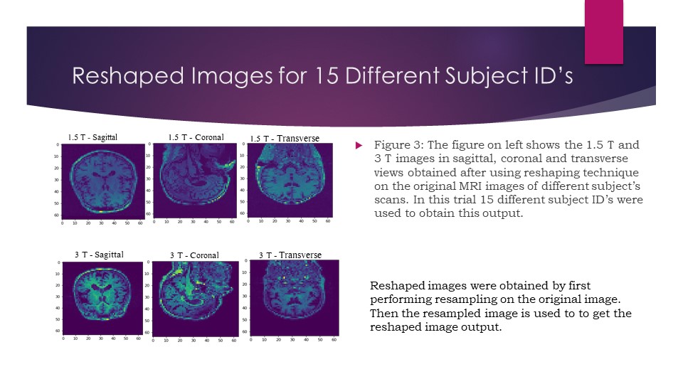 Github Saisjoshi Classification Alzheimers Disease 3d Vision Transformer