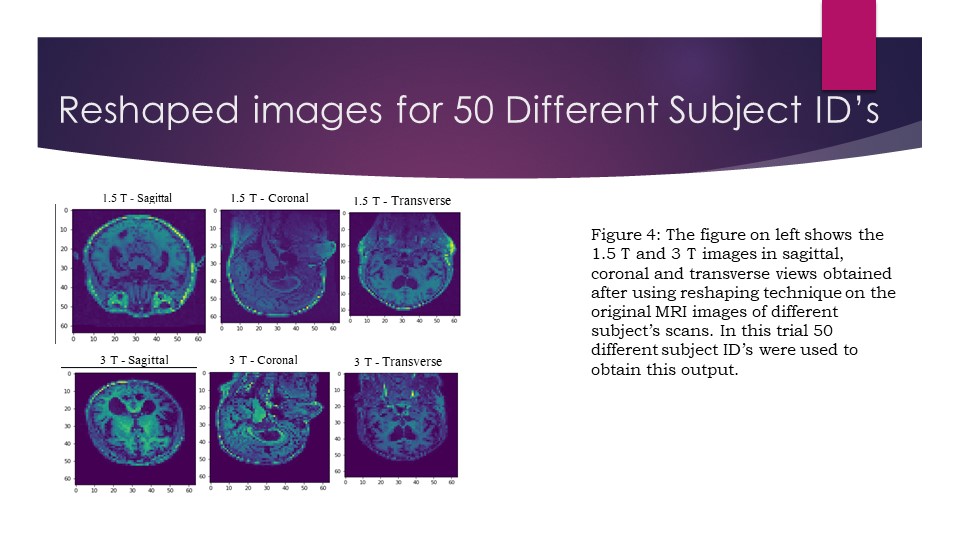 GitHub - SaiSJoshi/classification_alzheimers_disease_3D_vision_transformer