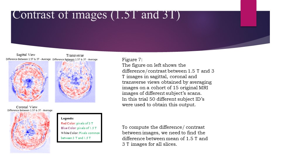 GitHub - SaiSJoshi/classification_alzheimers_disease_3D_vision_transformer