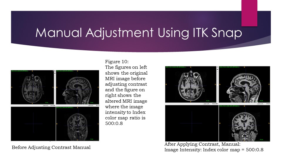 GitHub - SaiSJoshi/classification_alzheimers_disease_3D_vision_transformer