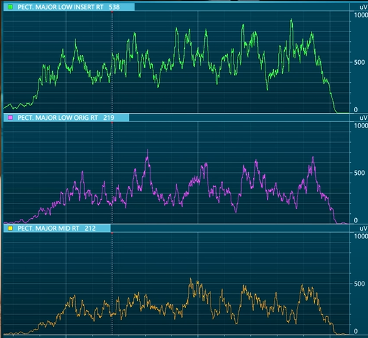 GitHub - lawrior/EMG-tested-calisthenics-workouts-by-Ryan-Humiston ...