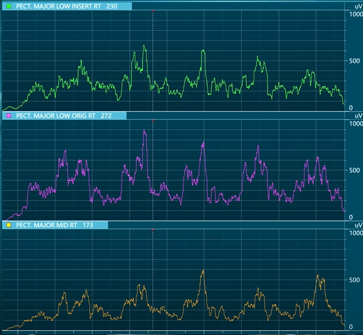 GitHub - lawrior/EMG-tested-calisthenics-workouts-by-Ryan-Humiston ...