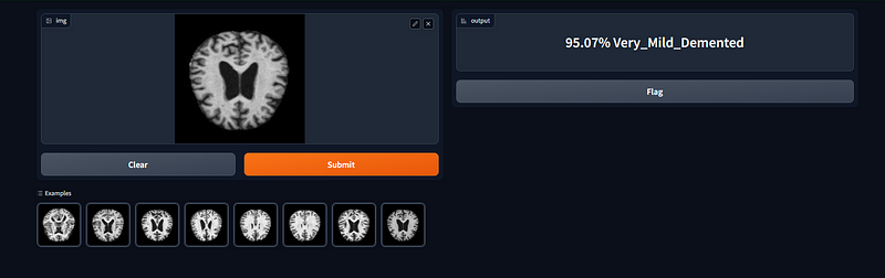 GitHub - oguzgnrn/HackathonProject-DeepLearningForDementia: Deep ...