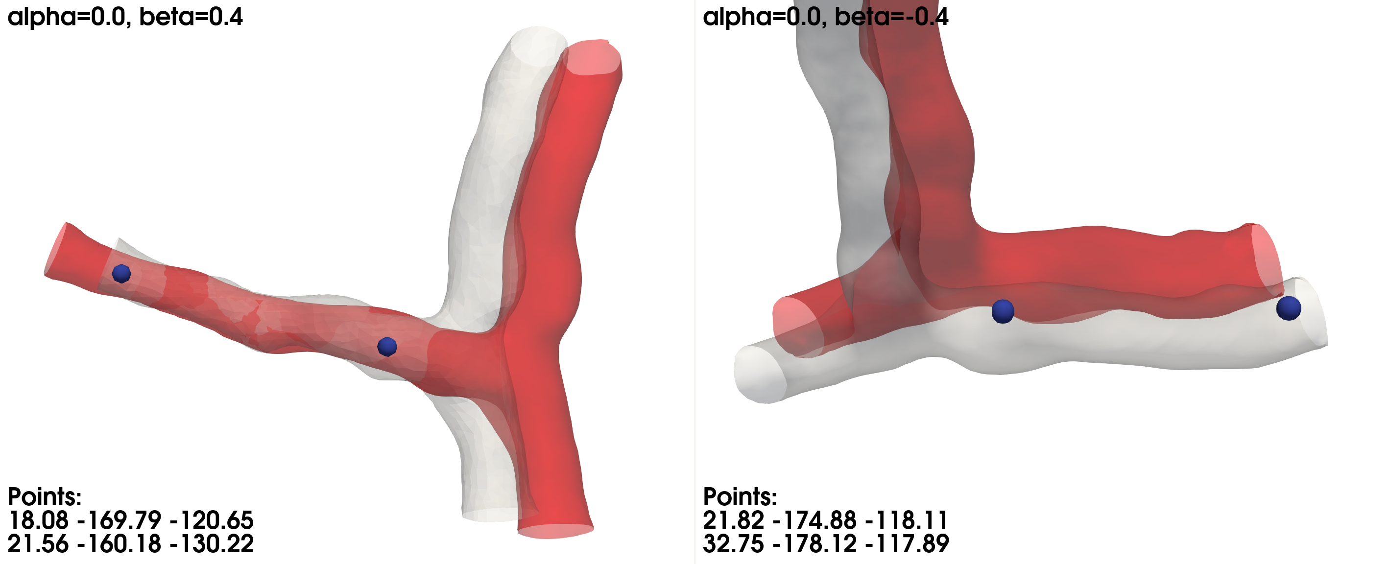 Extension/Reduction of a vascular segment · Issue #74 · KVSlab/morphMan ...