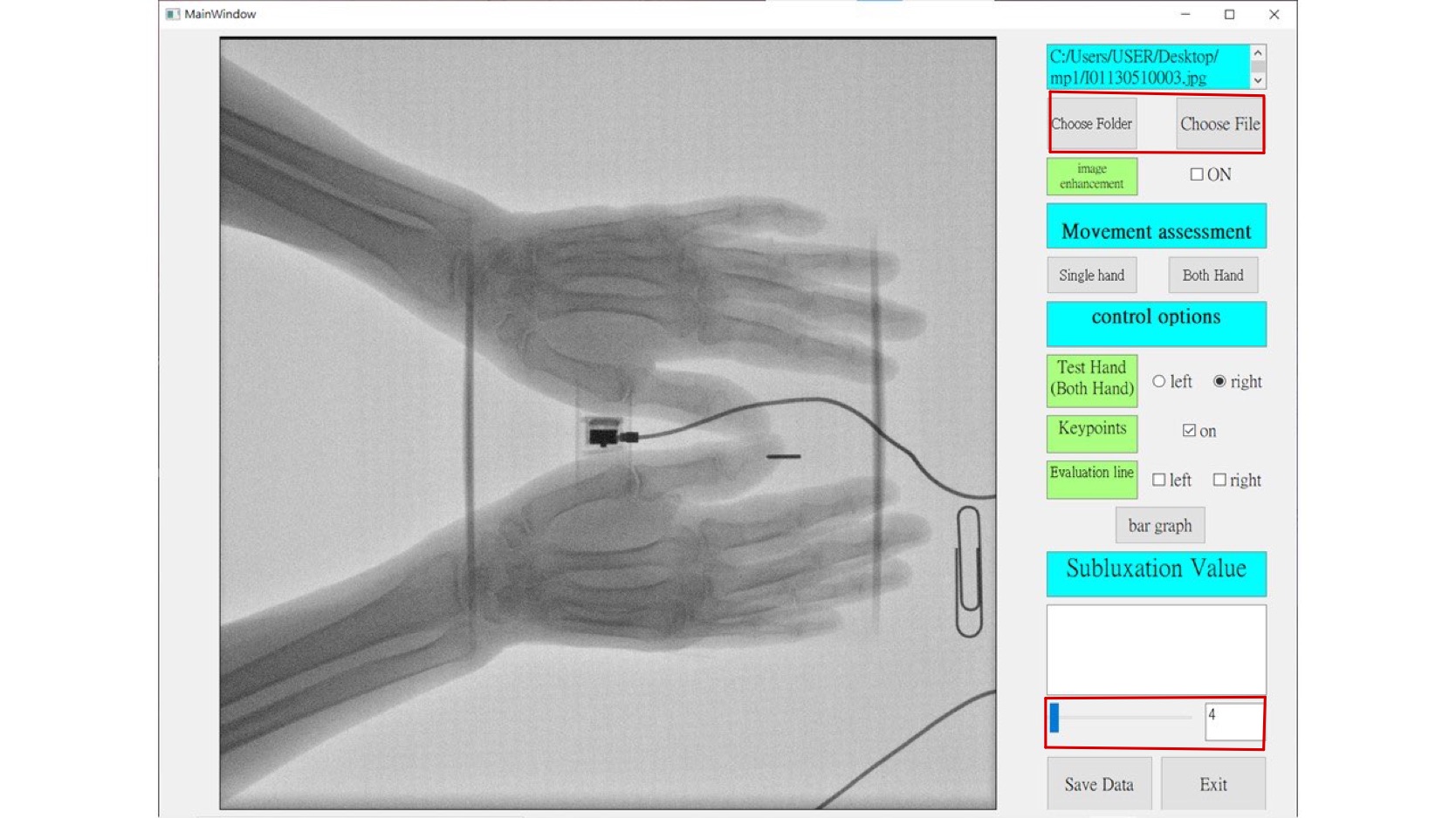 GitHub - chenchihan/AI_keypoint-detection