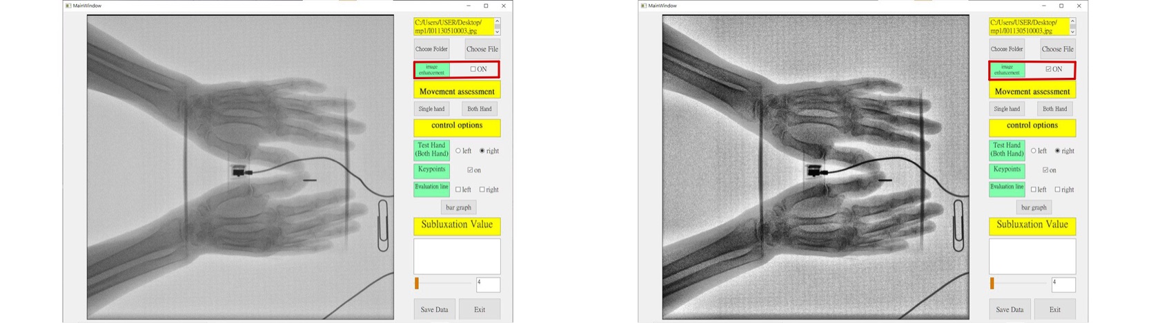 GitHub - chenchihan/AI_keypoint-detection