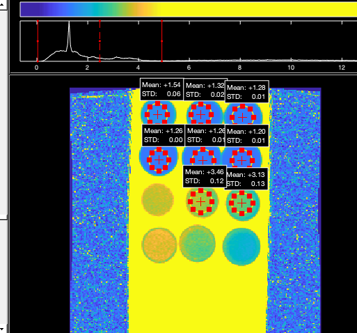 Unrecognised Function or Variable ‘vfa_t1’ · Issue #449 · qMRLab/qMRLab · GitHub
