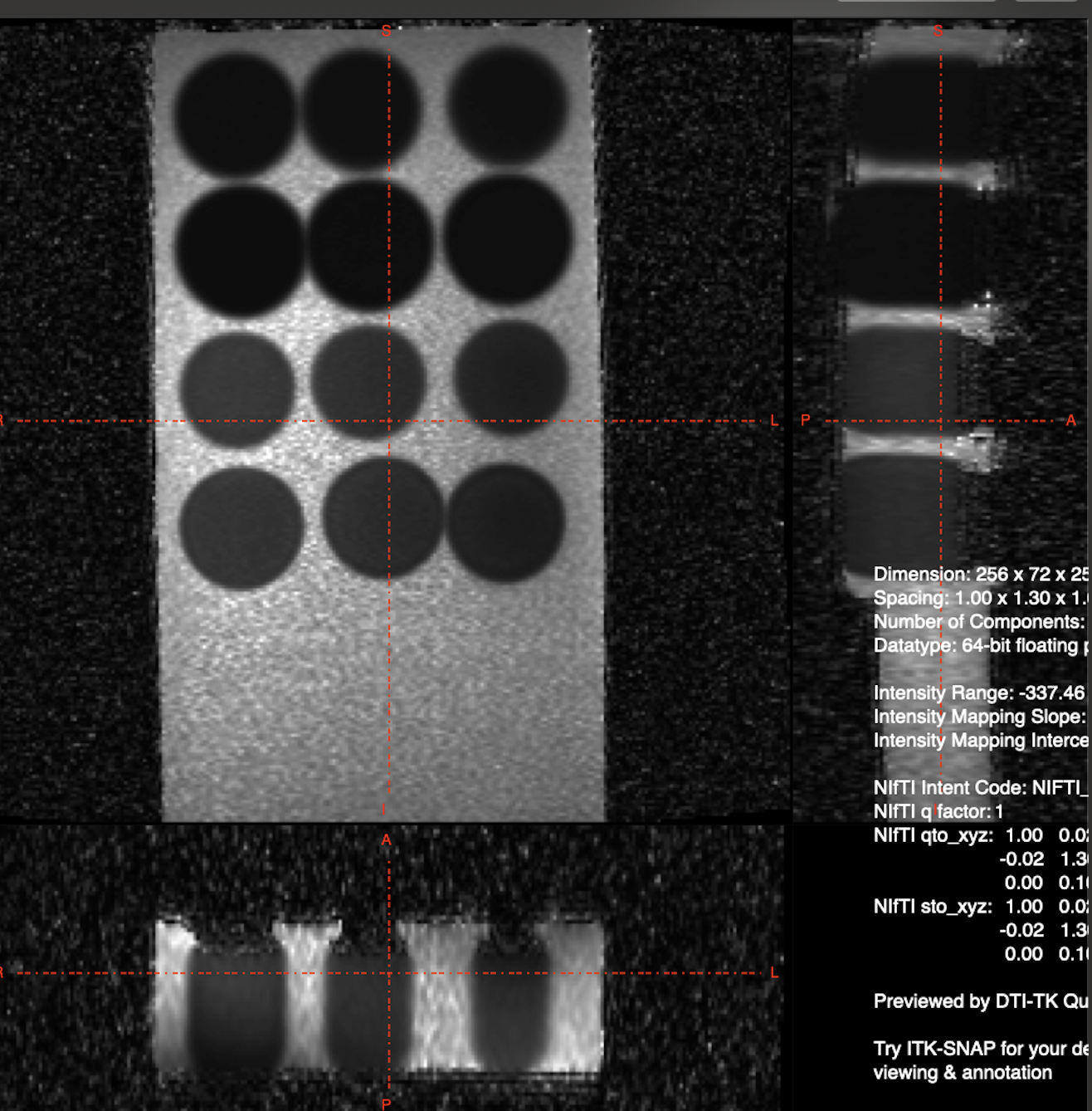 Unrecognised Function or Variable ‘vfa_t1’ · Issue #449 · qMRLab/qMRLab · GitHub