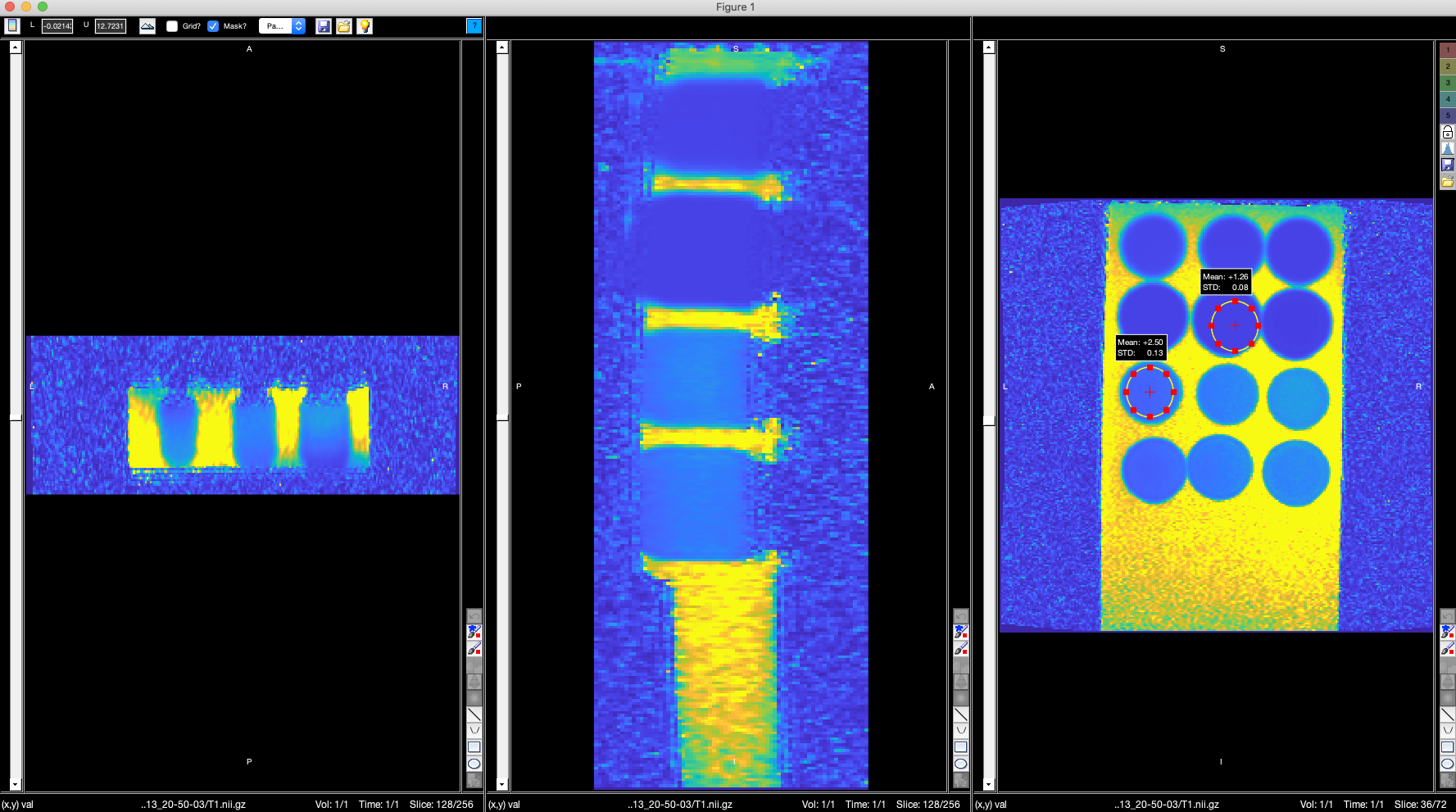 Unrecognised Function or Variable ‘vfa_t1’ · Issue #449 · qMRLab/qMRLab · GitHub
