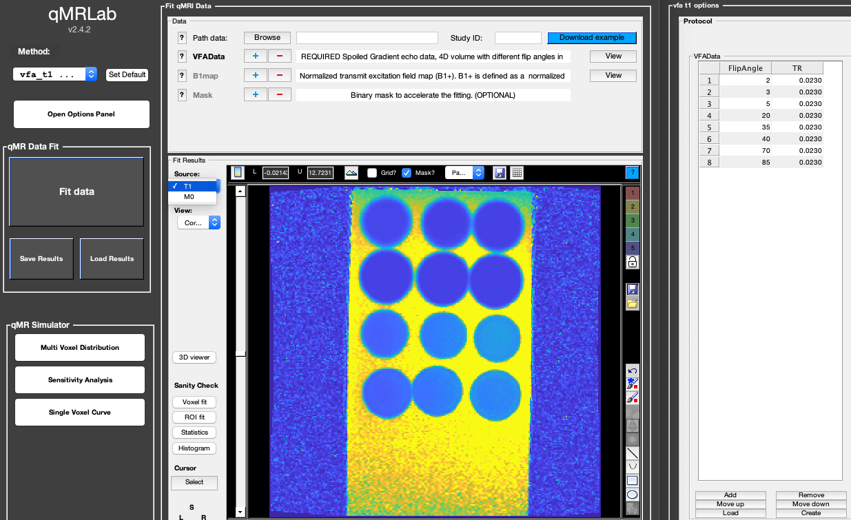 Unrecognised Function or Variable ‘vfa_t1’ · Issue #449 · qMRLab/qMRLab · GitHub