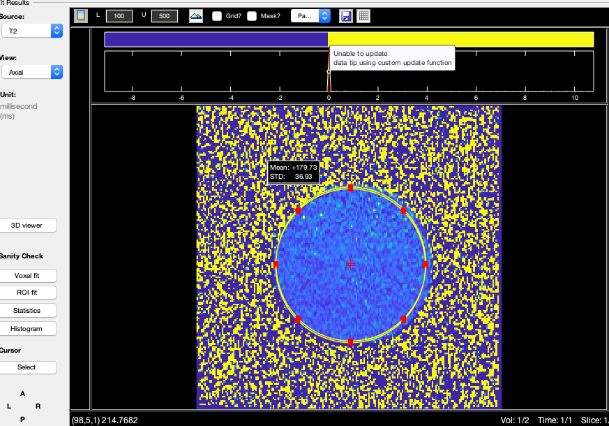 Question about T2 Fitting · Issue #464 · qMRLab/qMRLab · GitHub
