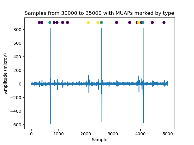 Github Ahmed Waseem77 Emg Decomposition Emg Decomposition Of A Signal Contianing Motor Unit