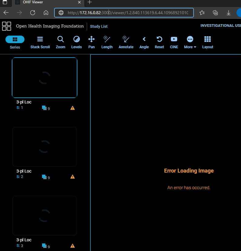 OHIF with Orthanc: error loading image + 401 unauthorized + 400 Bad Request · Issue #2667 · OHIF ...