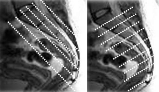 sacrum · Issue #4 · TechnicalMSK/MSK-MRI · GitHub