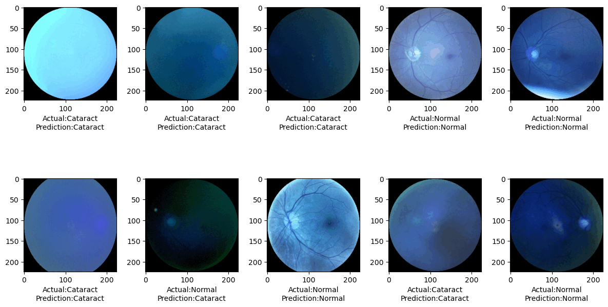 GitHub - Zyad-Abdelhafiz/Eye-Diseases-Using-Fundus
