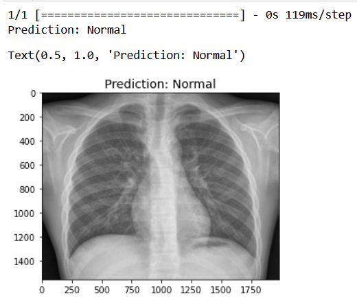 GitHub - vq7484/Explainable-AI-for-Pneumonia-Classification
