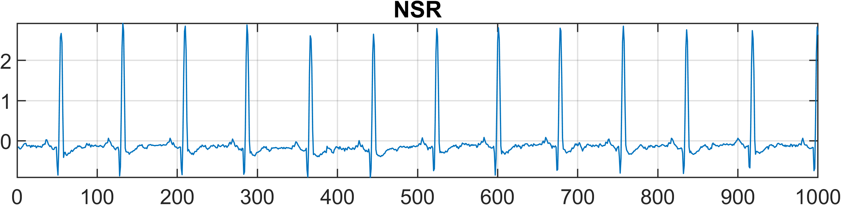Github Farhadabedinzadeh Classify Time Series Using Deep Learning