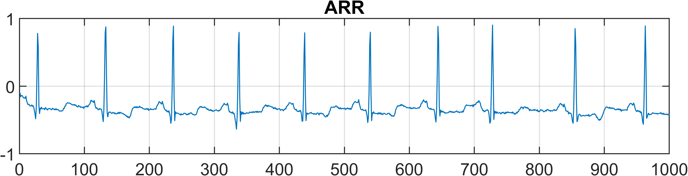 GitHub - farhadabedinzadeh/Classification-of-Arrhythmia