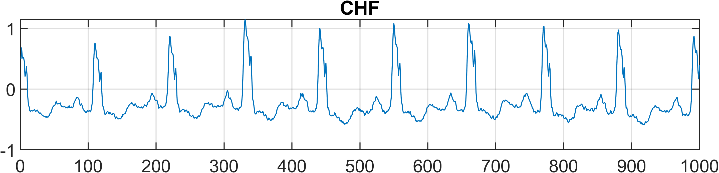 GitHub - farhadabedinzadeh/Classification-of-Arrhythmia
