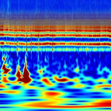 GitHub - farhadabedinzadeh/Classification-of-Arrhythmia