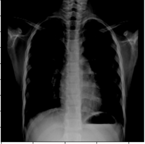 GitHub - smtakn44/chest_xray_classification: Deep learning neural network model codes for Colab