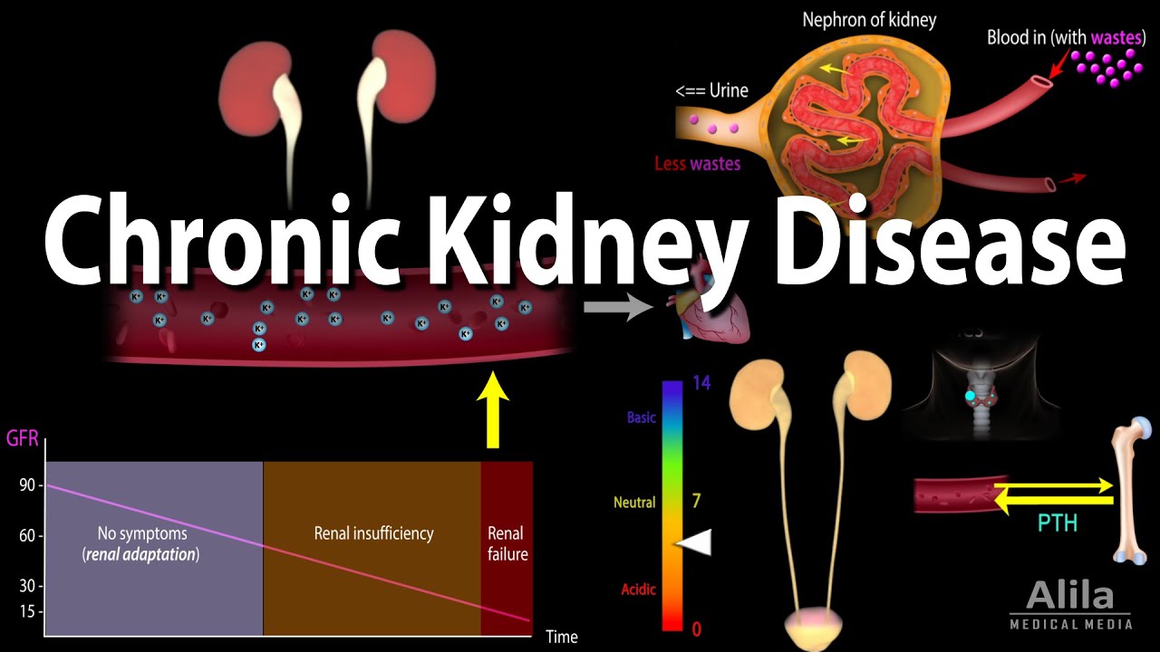 GitHub - Ivan-Meng0115/Predict-Status-of-Chronic-Kidney-Disease: In ...