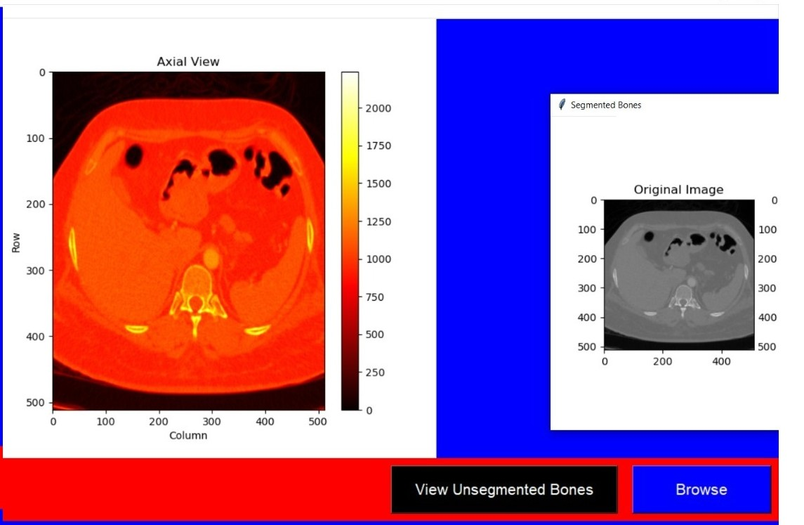 GitHub - HussFekry/MediScan-3D-Advanced-DICOM-Visualization-Platform: ediScan 3D" is an ...