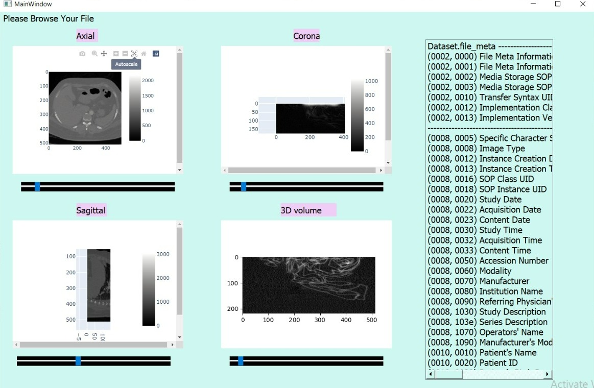 GitHub - HussFekry/MediScan-3D-Advanced-DICOM-Visualization-Platform: ediScan 3D" is an ...