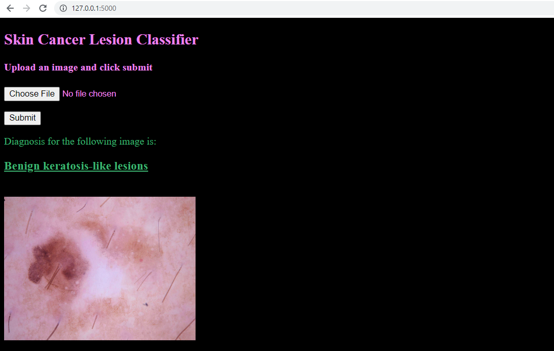 GitHub - ShrirangHadule/cancer_prediction_by_images: Deep learning model based image classification