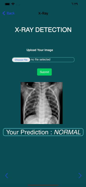 GitHub - ahmedmohamedaboelsood/Chest-disease-detection-using-X-ray-IOS-APP