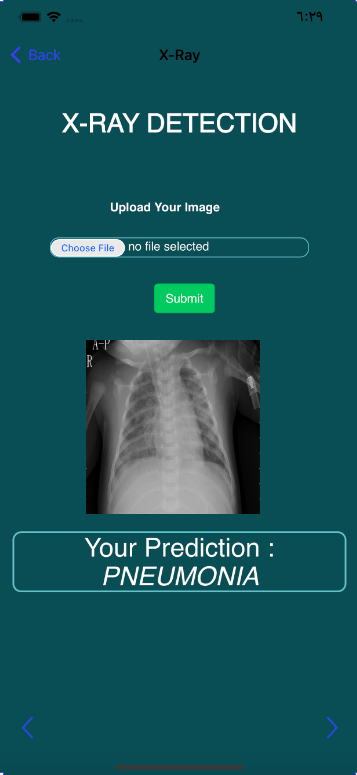 GitHub - ahmedmohamedaboelsood/Chest-disease-detection-using-X-ray-IOS-APP