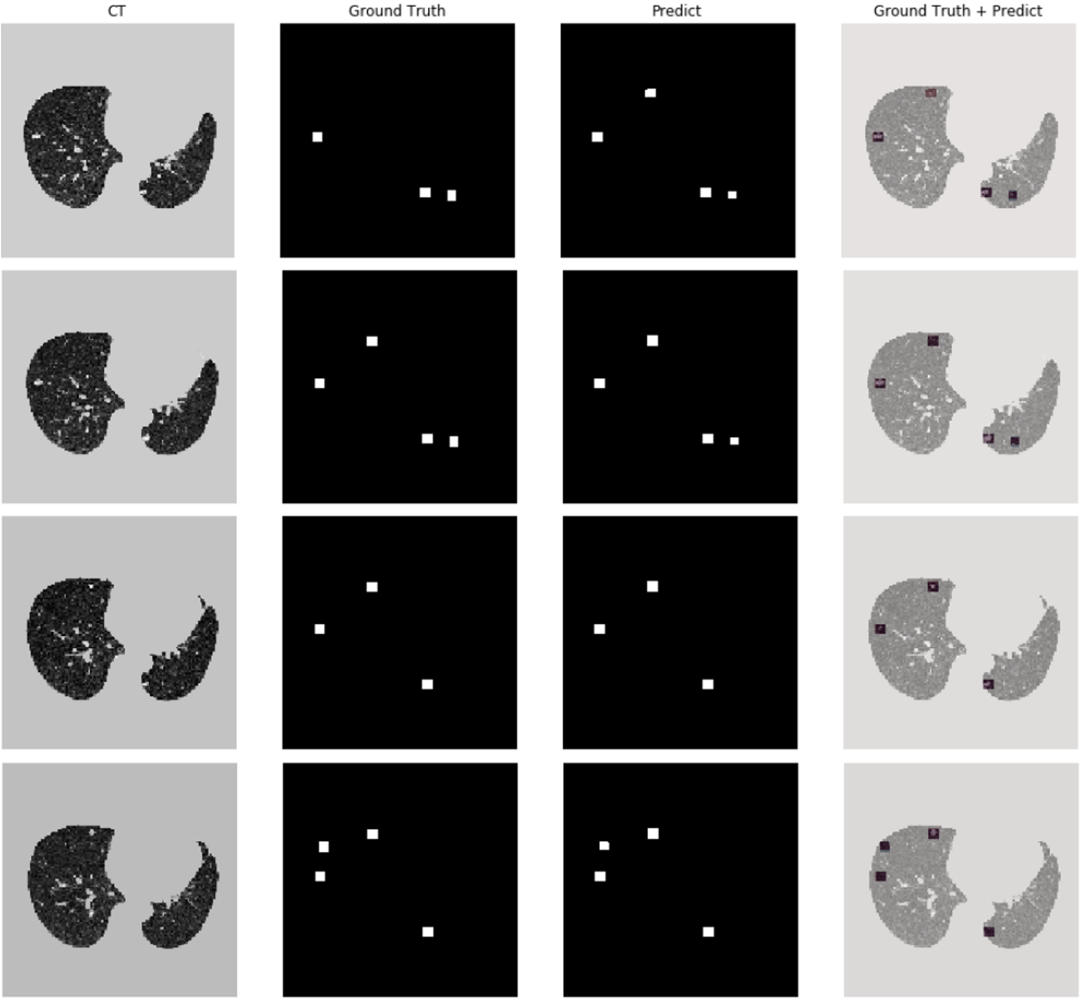 GitHub - yerang823/3D-Unet-seg