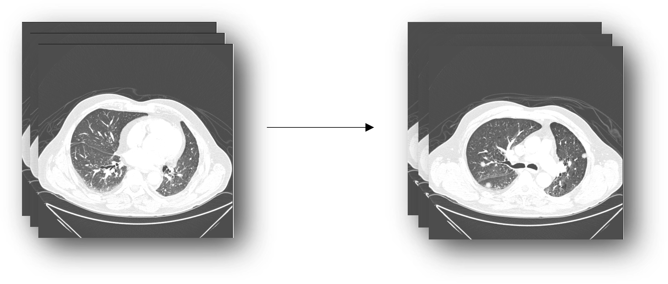 GitHub - yerang823/3D-CT-GAN