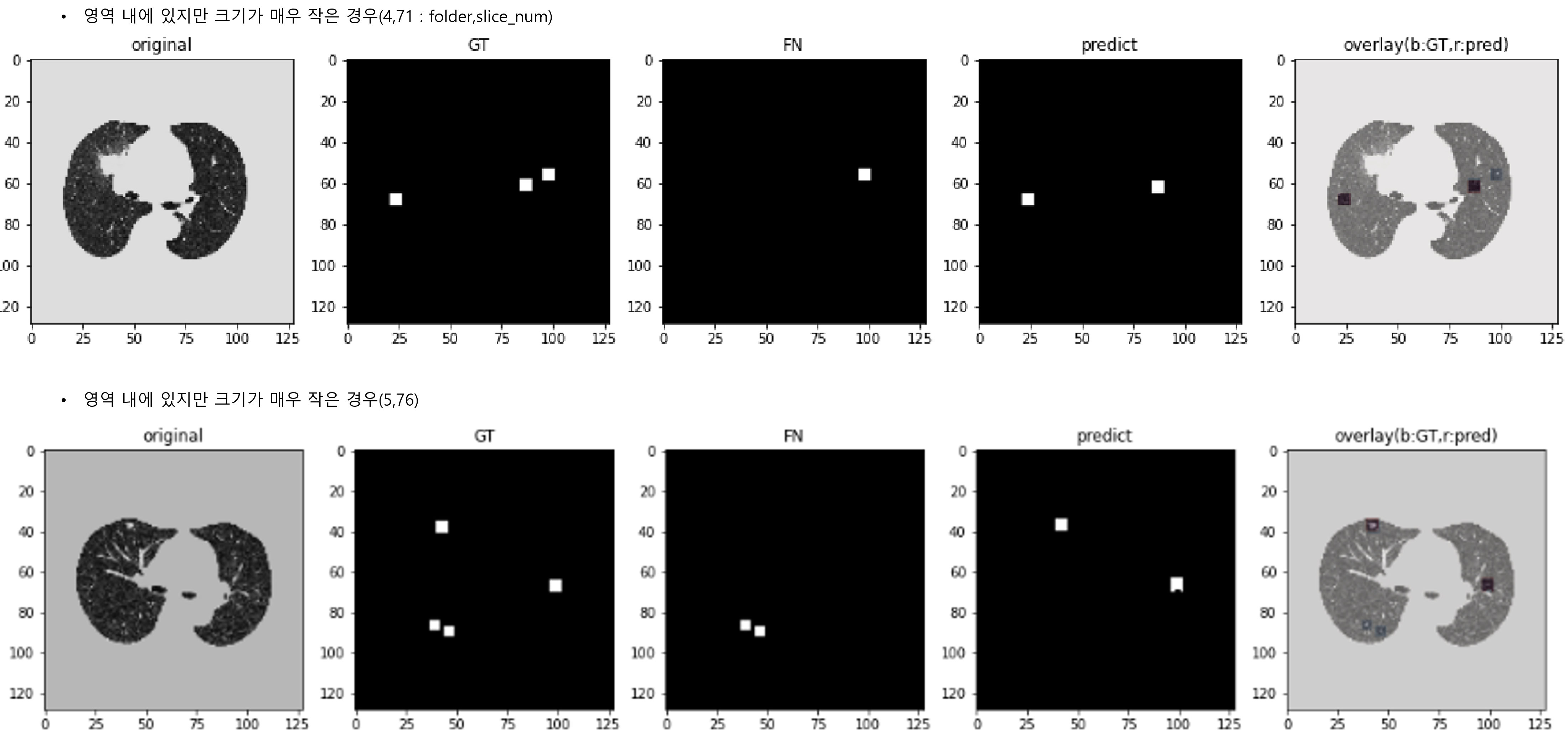 GitHub - yerang823/3D-Unet-seg
