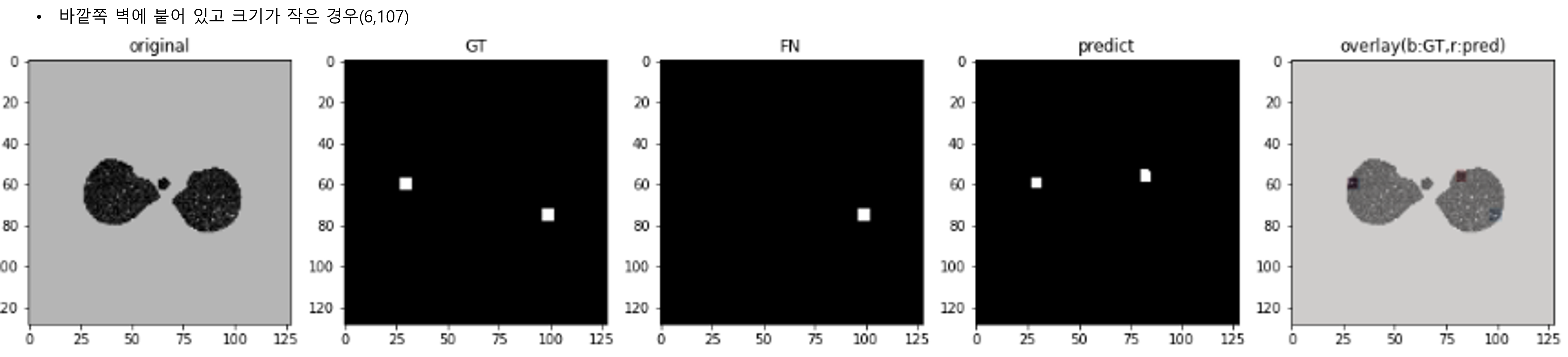 GitHub - yerang823/3D-Unet-seg