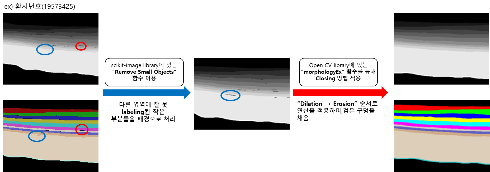 GitHub - Hoon-Hoon-Tiger/OCT_Segementation
