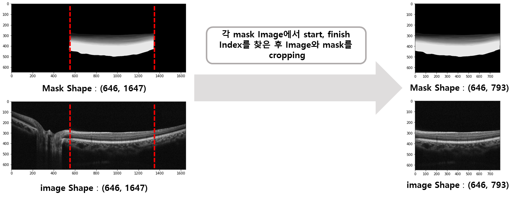 GitHub - Hoon-Hoon-Tiger/OCT_Segementation