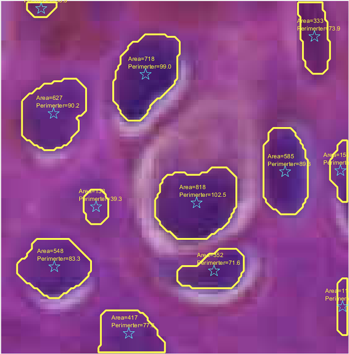 GitHub - RenaissanceT/Image-Segmentation-and-Analysis-MATLAB: Segment ...